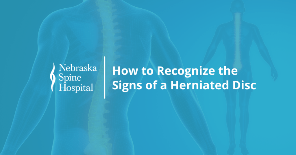 The Signs of a Herniated Disc - Nebraska Spine Hospital